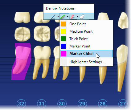 Making Visual Notations in the Patient Chart | The Dentrix Blog