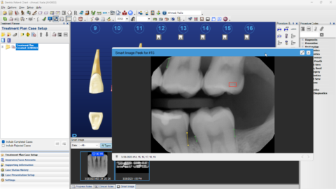 Accessing Dentrix Detect AI Images from Within the Patient Chart | The ...