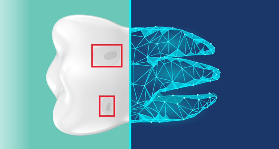 AIDE Your Image Diagnosis By Seeing Four Views at Once | The Dentrix Blog